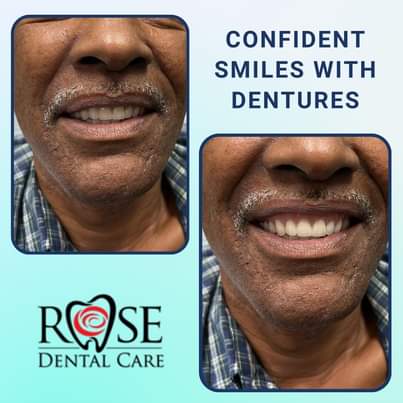 Smile Gallery Tyler, TX | Rose Dental Care